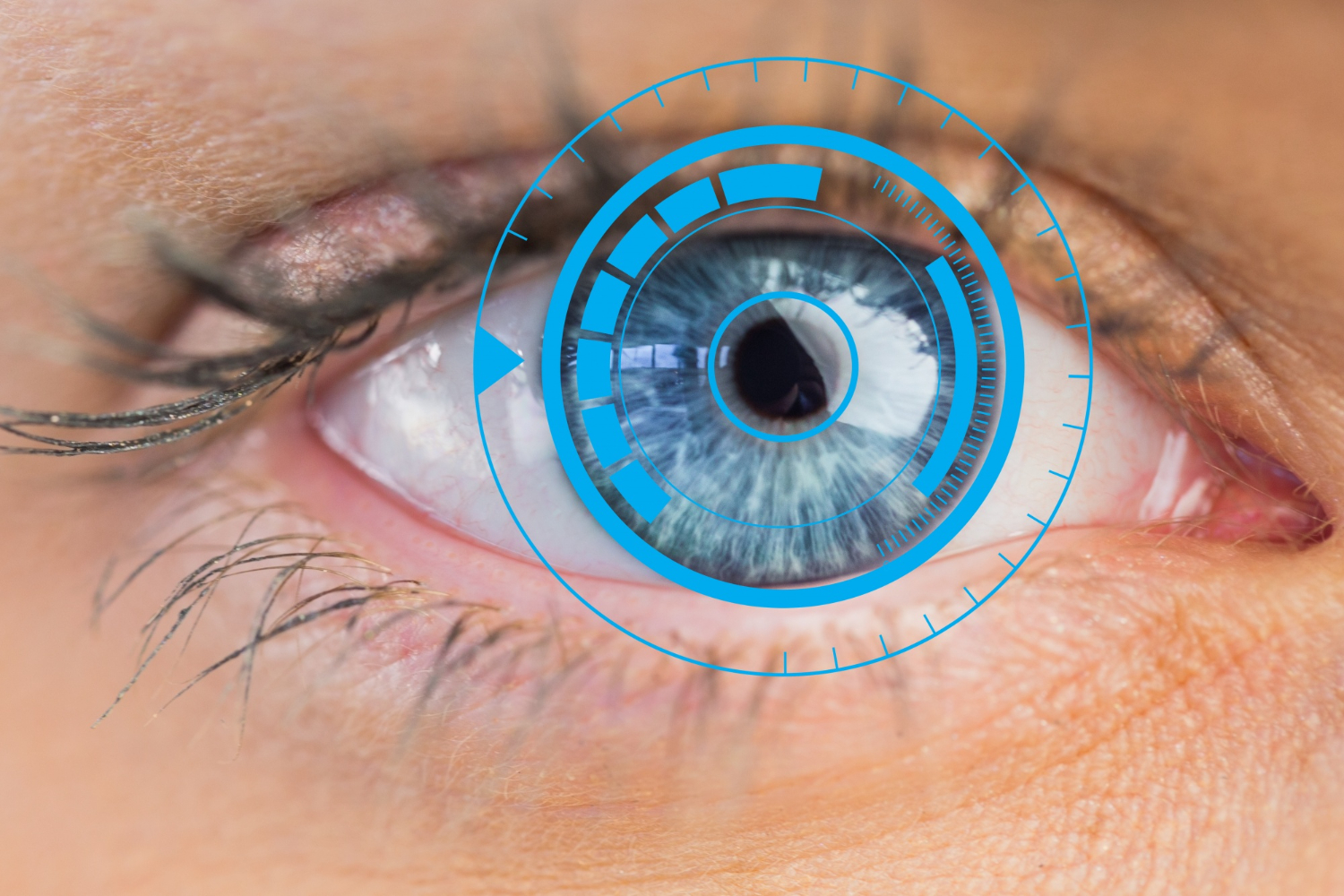 LASIK Recovery Timeline: What to Expect After Surgery
